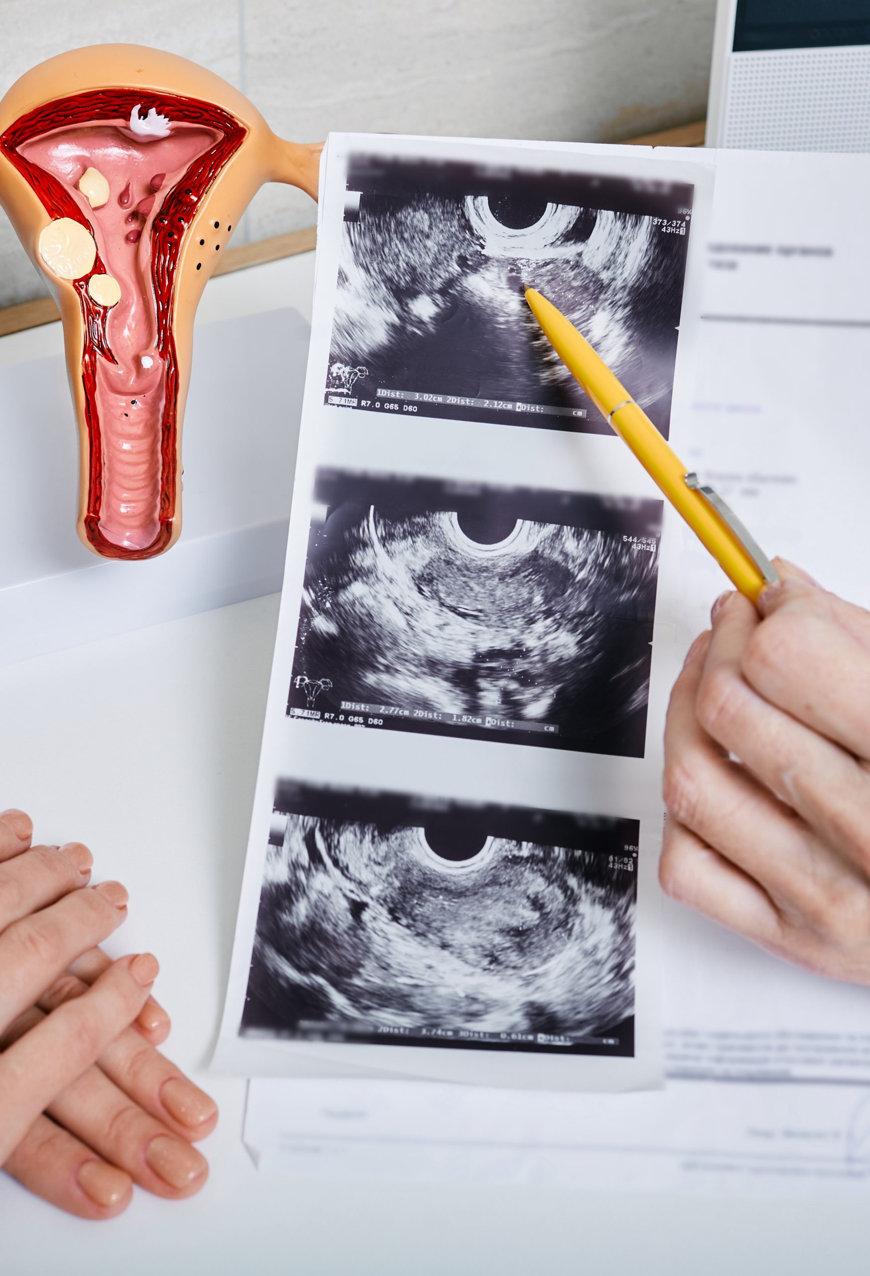 Free Ovarian Reserve Testing - New Hope Fertility of Texas