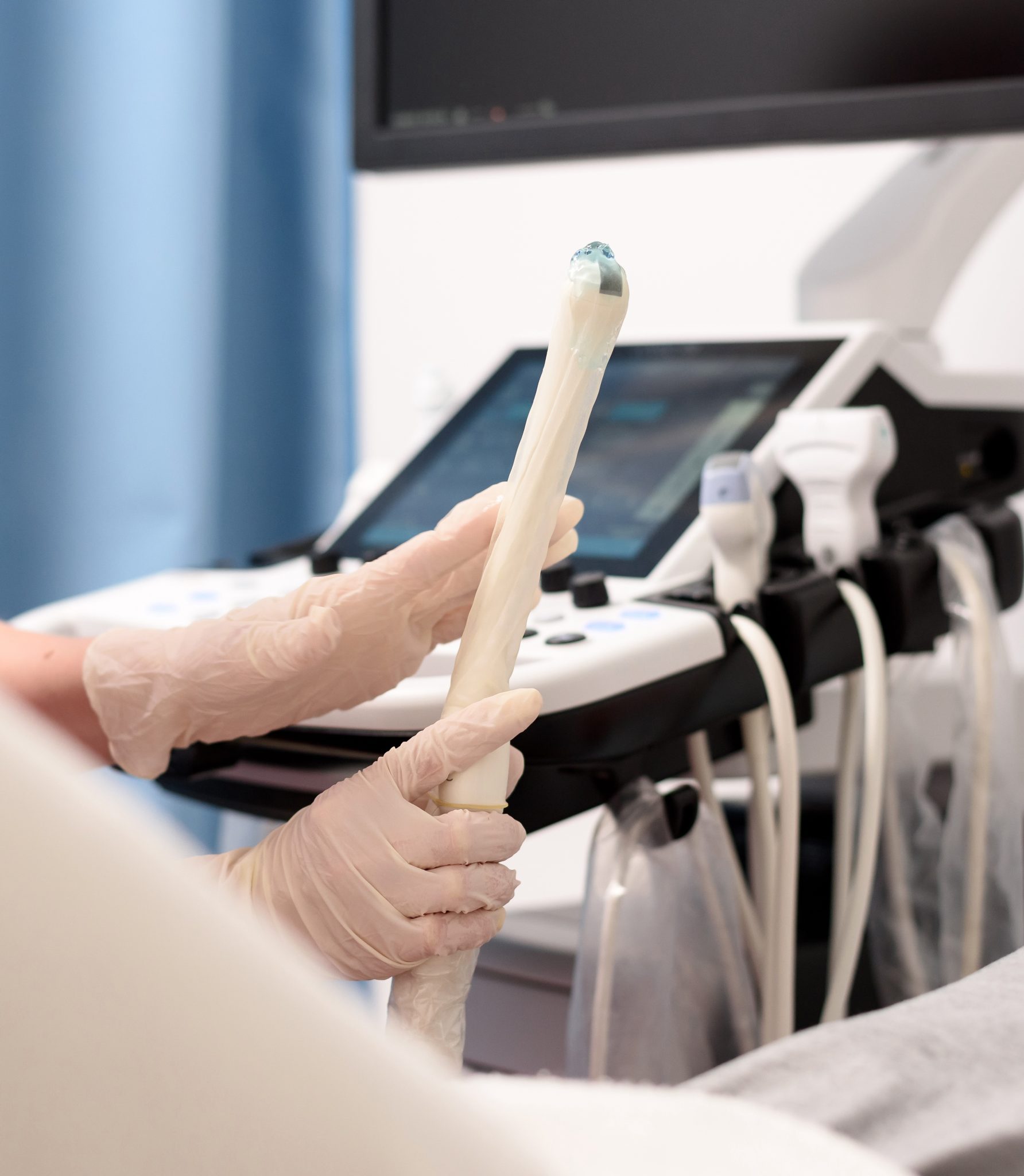 Free Ovarian Reserve Testing - New Hope Fertility of Texas